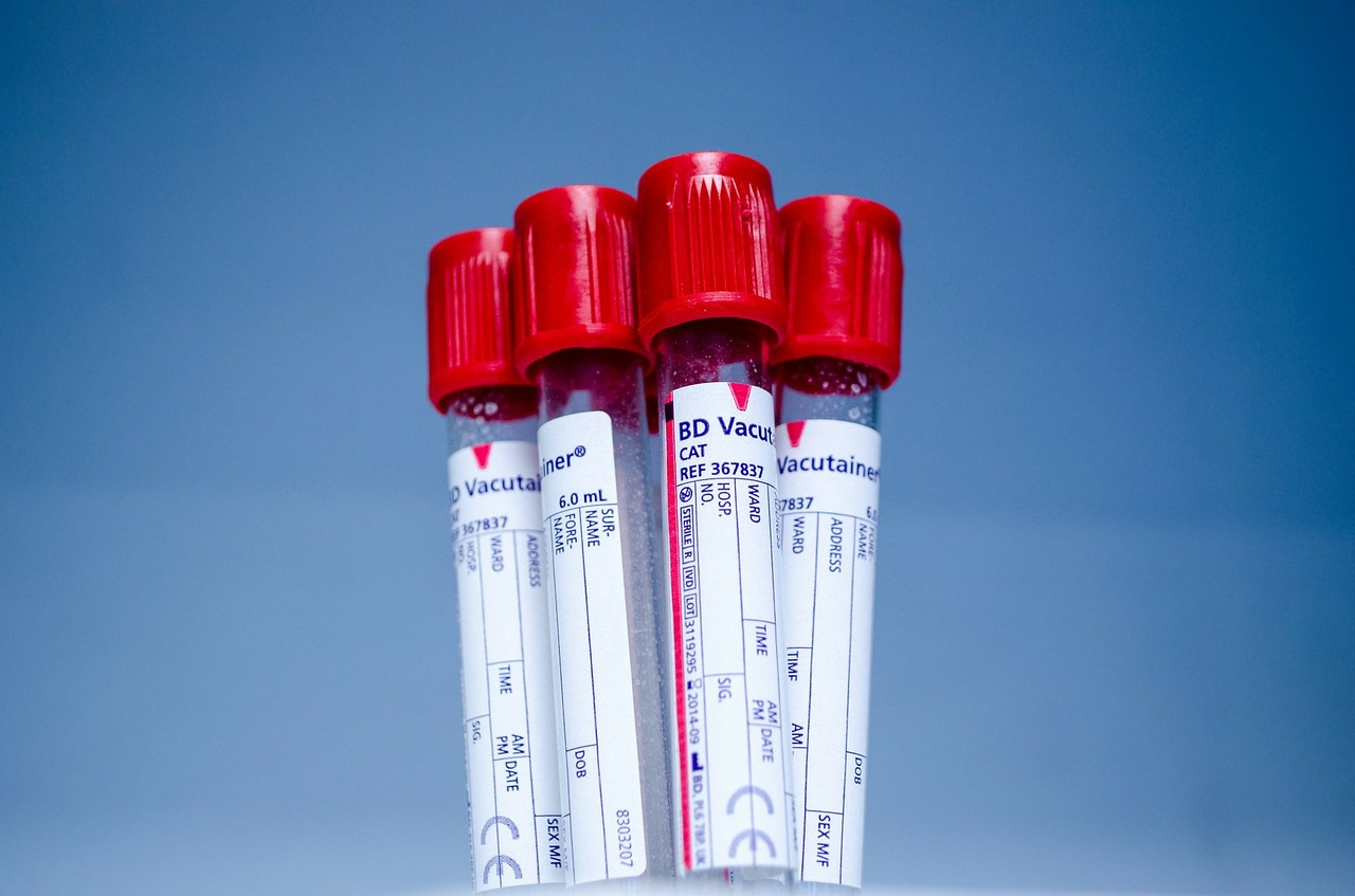 Which STDs can be checked with a blood test?