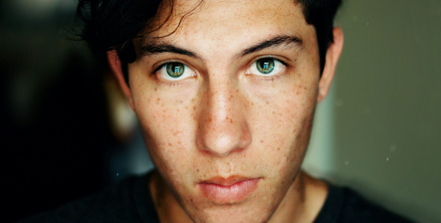 What STIs can cause a face rash?